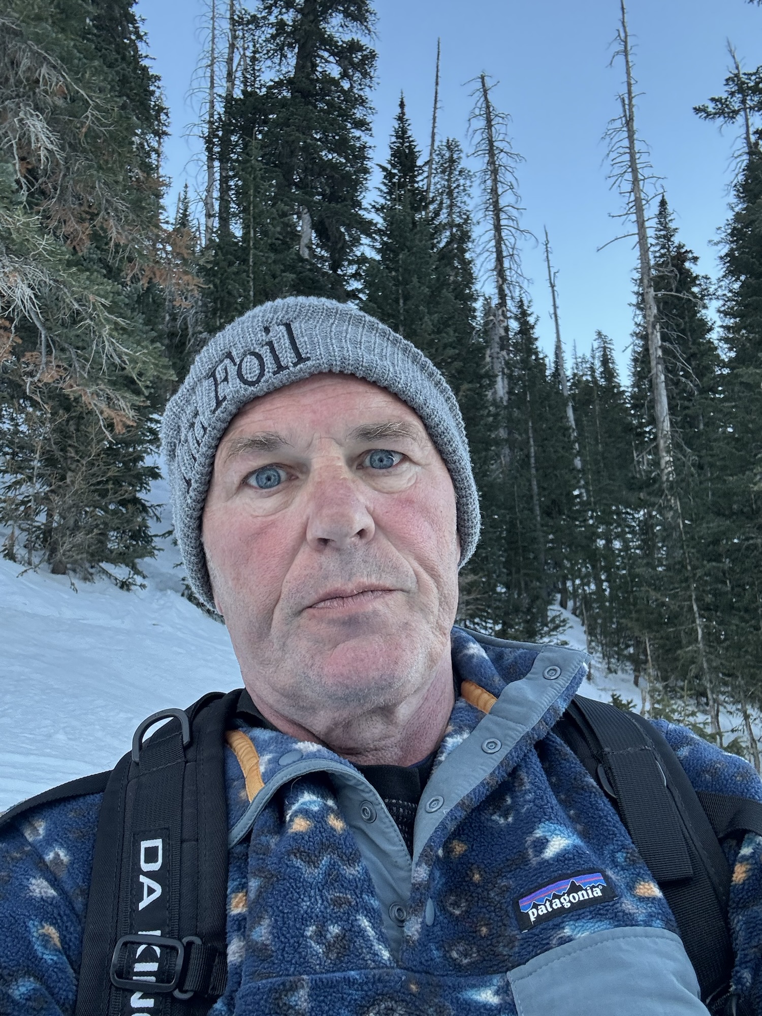 About Mark Tracey – Heal Your Hernia